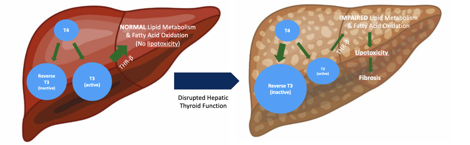 MASH - ALIGOS Therapeutics
